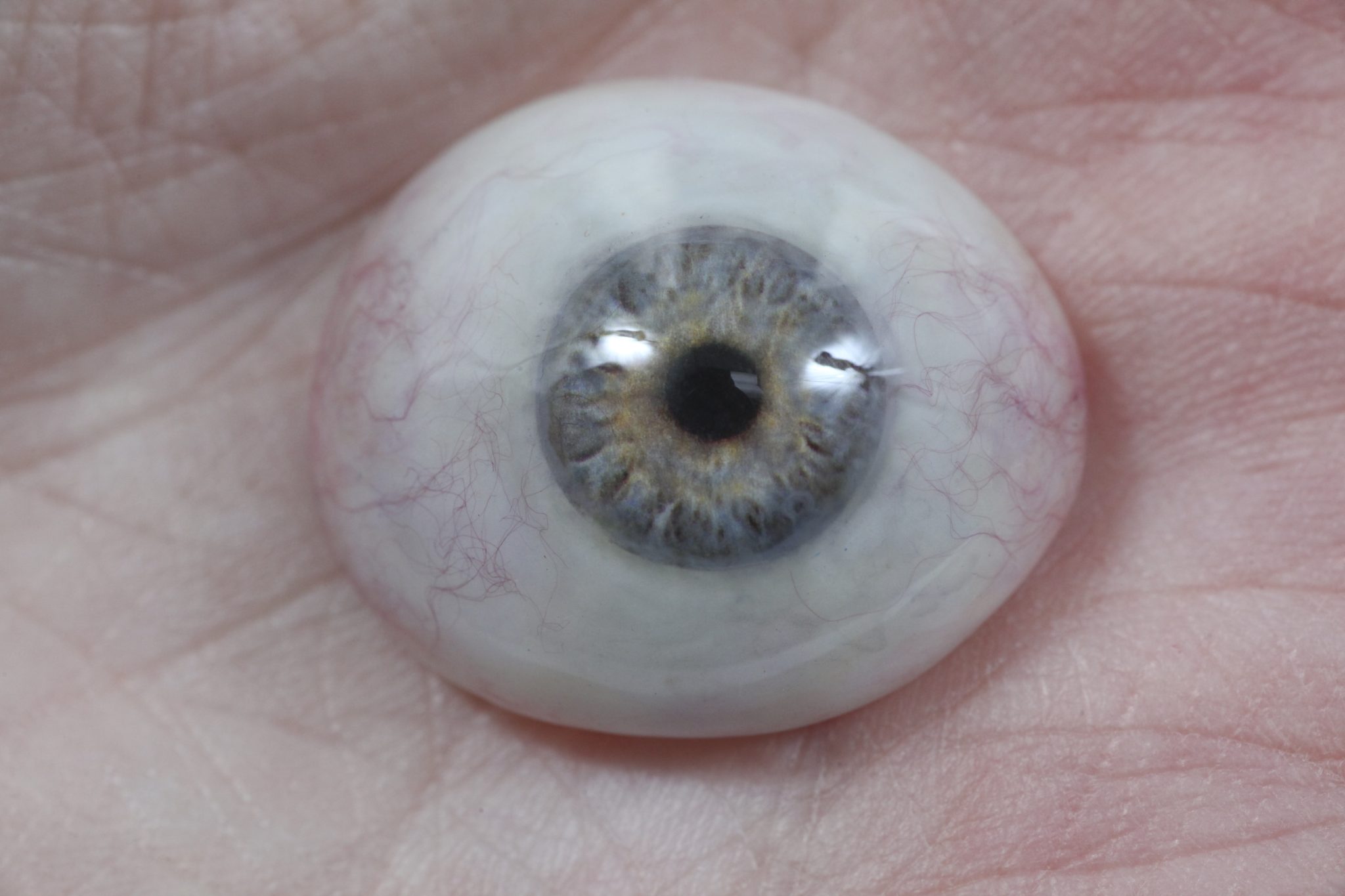 Eye Prosthesis Creation – Making Your New Ocular Prosthesis - Ocular ...