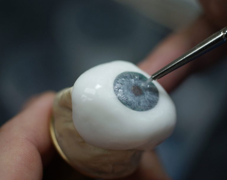 Ocularists - Ocular Prosthetics Internet Database, Ocularists Database ...